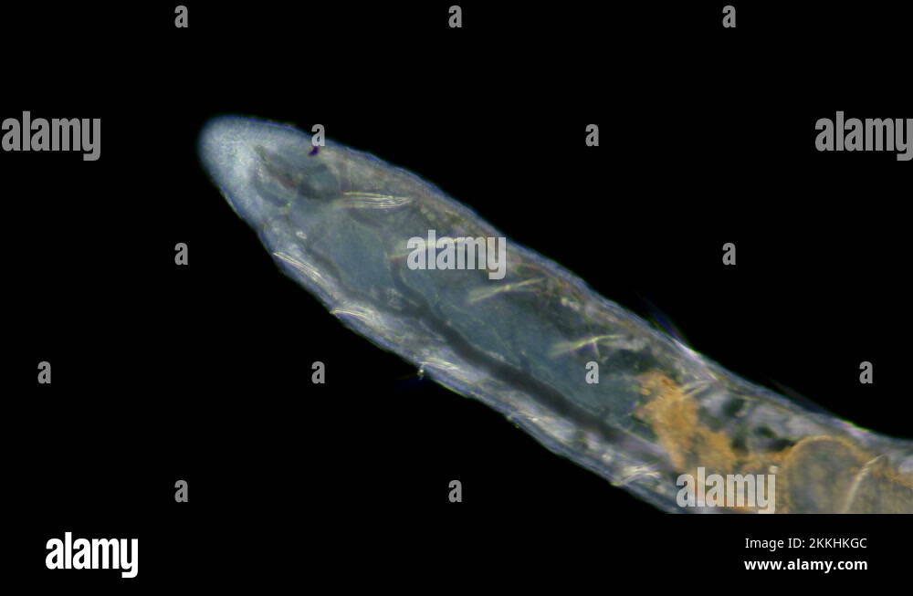 worm Nais sp. under a microscope, Family Naididae, a class of ...