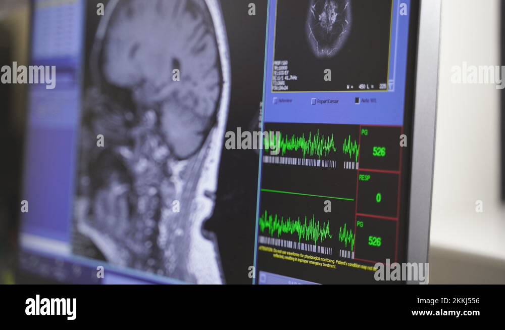 Radiologist x ray machine and screen Stock Videos & Footage - HD and 4K ...
