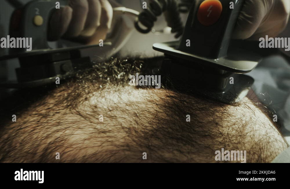 Doctor uses defibrillator to treat heart disease of unconscious patient ...