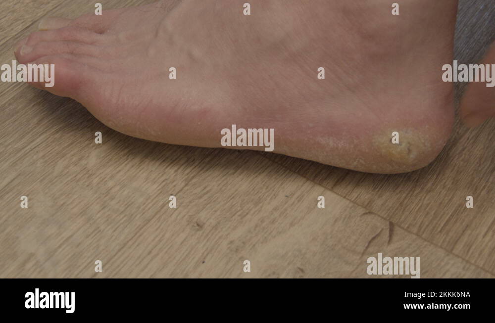 Large hump Stock Videos & Footage - HD and 4K Video Clips - Alamy