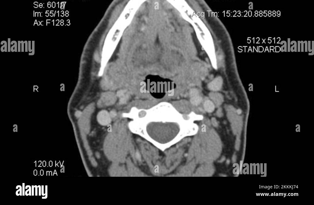 Chest axial ct scan Stock Videos & Footage - HD and 4K Video Clips - Alamy
