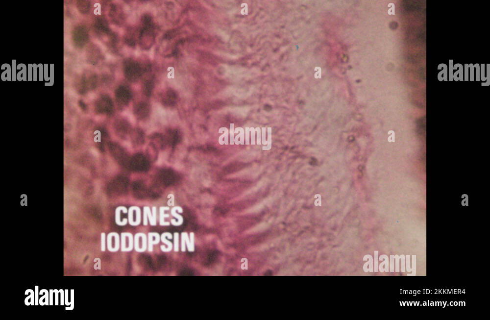 1960s: Photograph of cones and iodopsin around eye. Illustration of ...