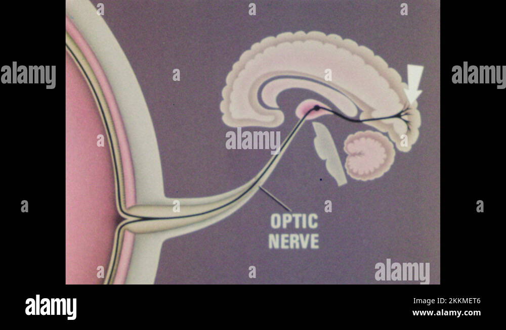 Optic nerve brain Stock Videos & Footage - HD and 4K Video Clips - Alamy