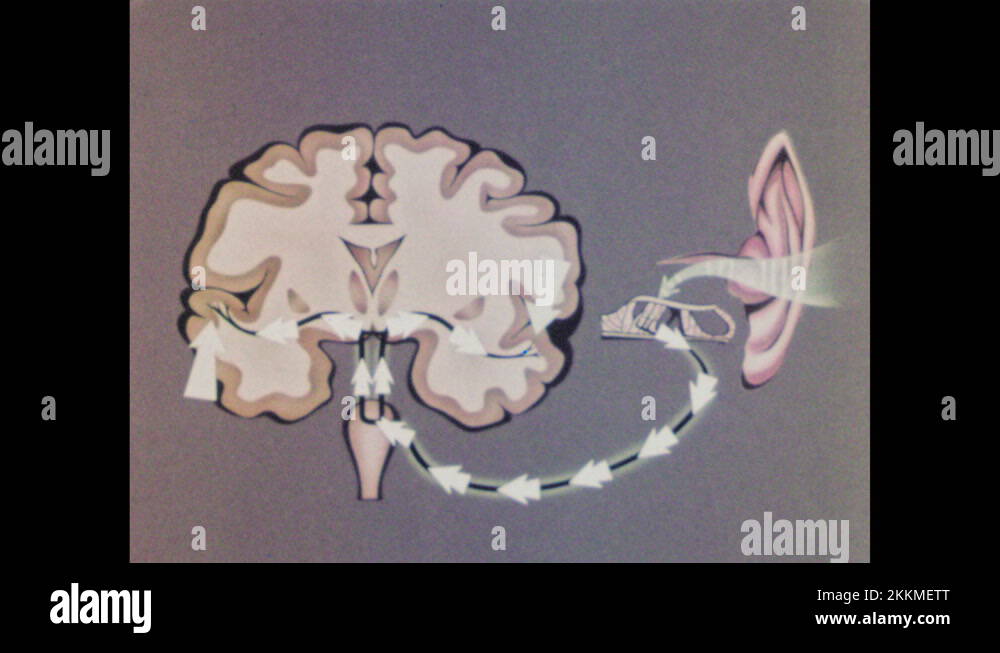 Auditory nerve Stock Videos & Footage - HD and 4K Video Clips - Alamy