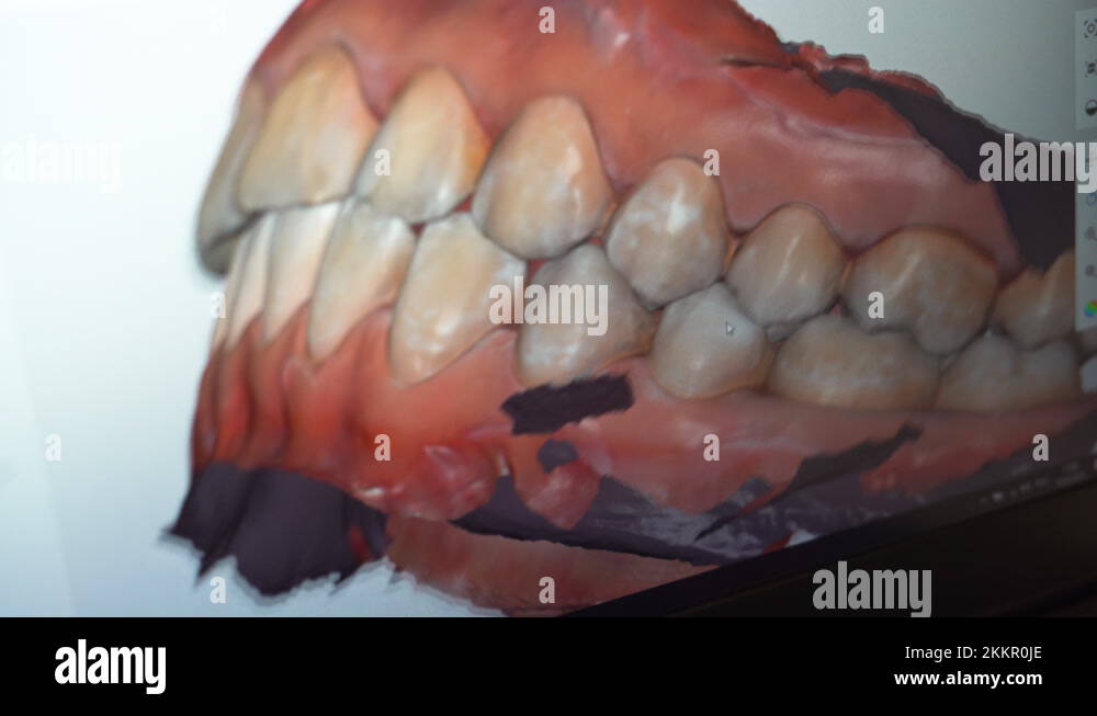 Dental consultation, diagnostics. Jaw scanning, digital imprint ...