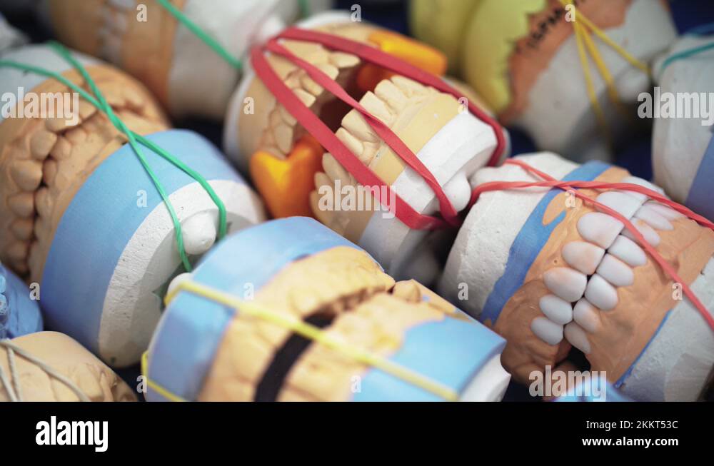 Sculpted plastic dentures in dentistry. Dental prosthetics. Jaws for 3D ...