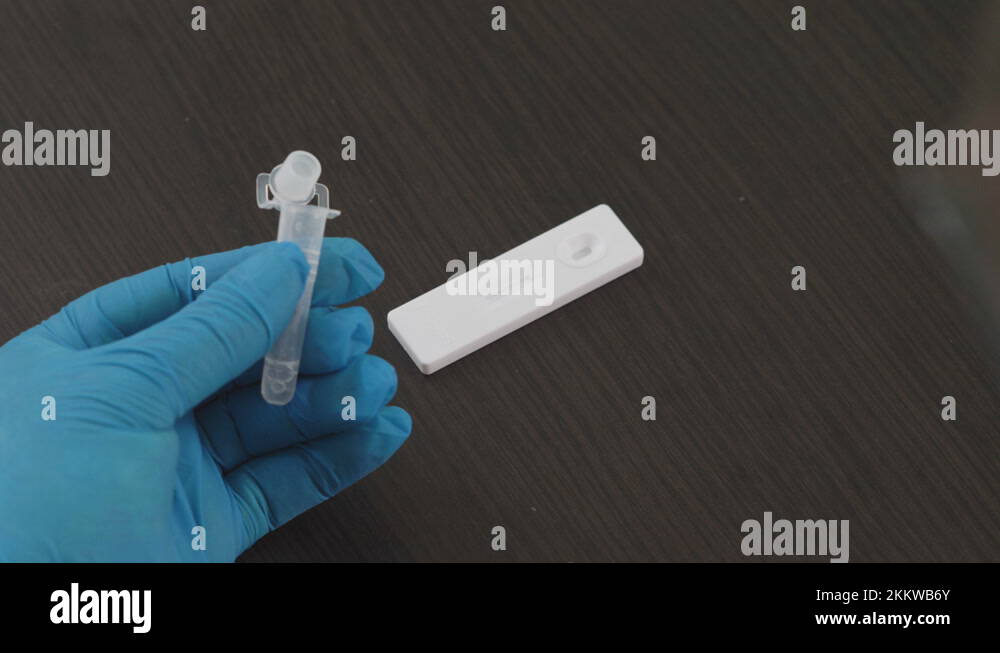 Self testing COVID-19 Coronavirus SARS-CoV-2 with fast methodology ...