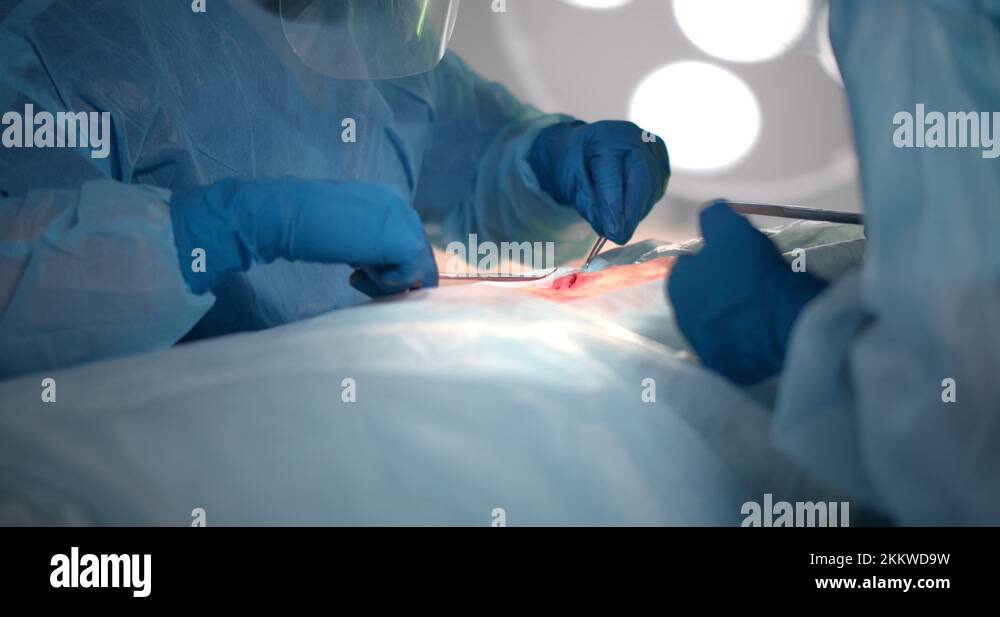 Gauze holder Stock Videos & Footage - HD and 4K Video Clips - Alamy