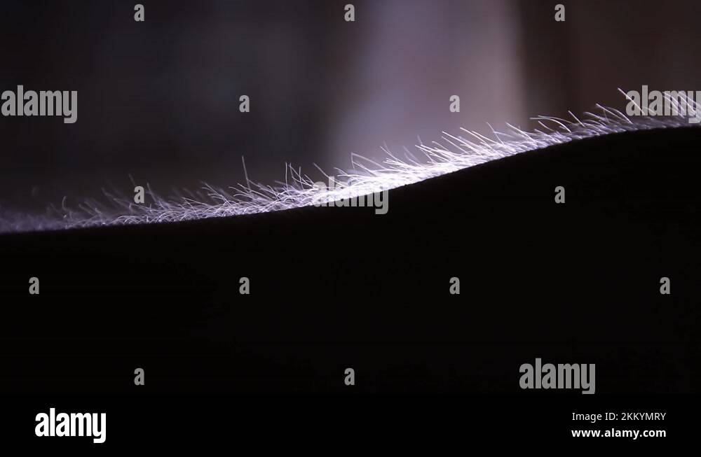 Arm hand goosebumps Stock Videos & Footage - HD and 4K Video Clips - Alamy