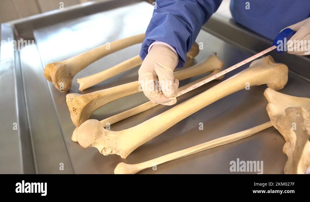 Human femur bone Stock Videos & Footage - HD and 4K Video Clips - Alamy