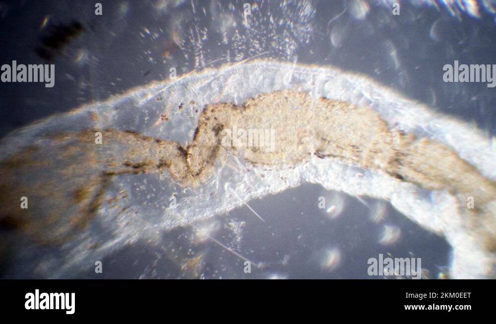 intestine of nematode under the microscope, 150x magnification Stock ...