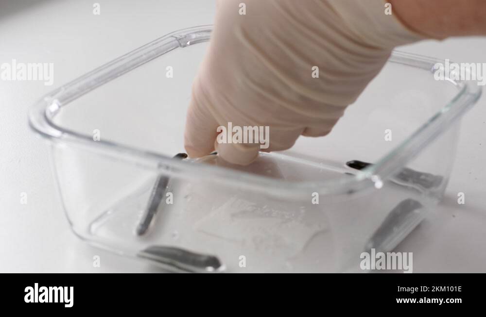 Medicinal leech in a glass bowl. Doctor takes the leech and prepares ...