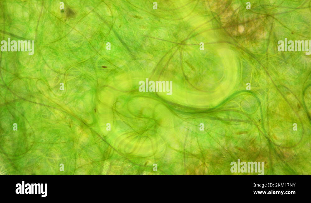 nematoda worm under a microscope, worm movement among algae, widely ...