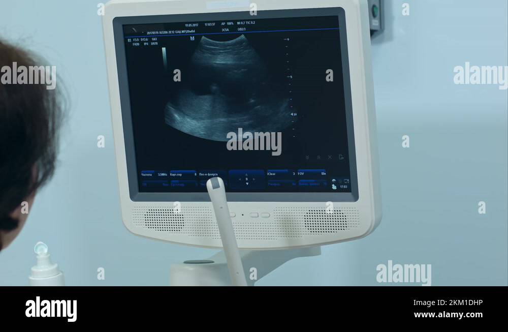 Female gynecologist checking fetal life with ultrasound scanner Stock ...