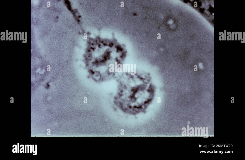 Cancer cells under microscope Stock Videos & Footage - HD and 4K Video ...