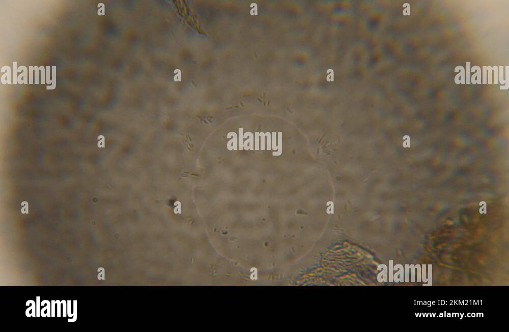 Bacteria Parasites and Worms in drinking Water under Microscope ...