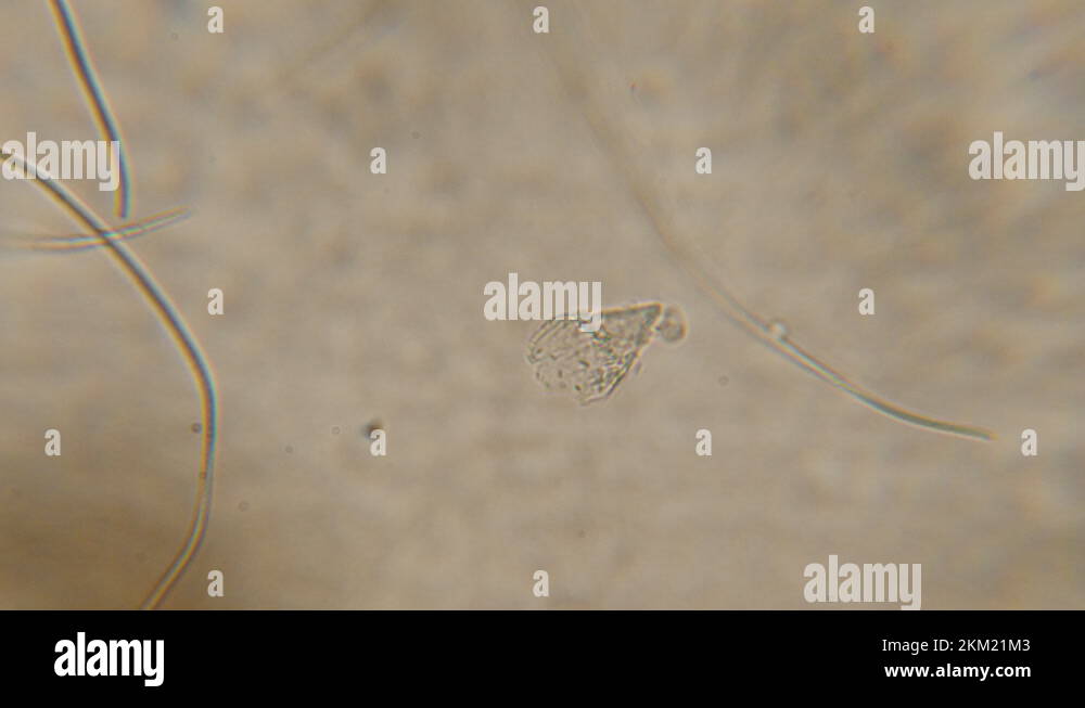 Bacteria Parasites and Worms in drinking Water under Microscope ...