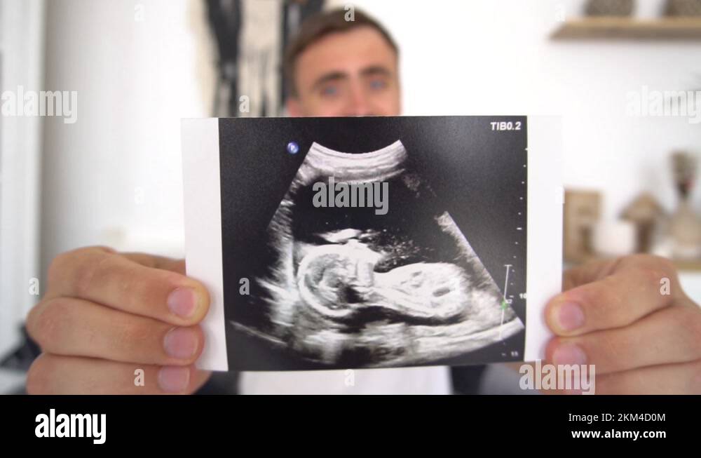 Ultrasound scan father Stock Videos & Footage - HD and 4K Video Clips ...