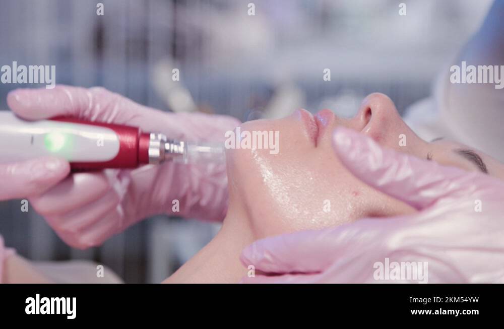 Woman beautician doing mechanical peeling of the face Stock Video ...