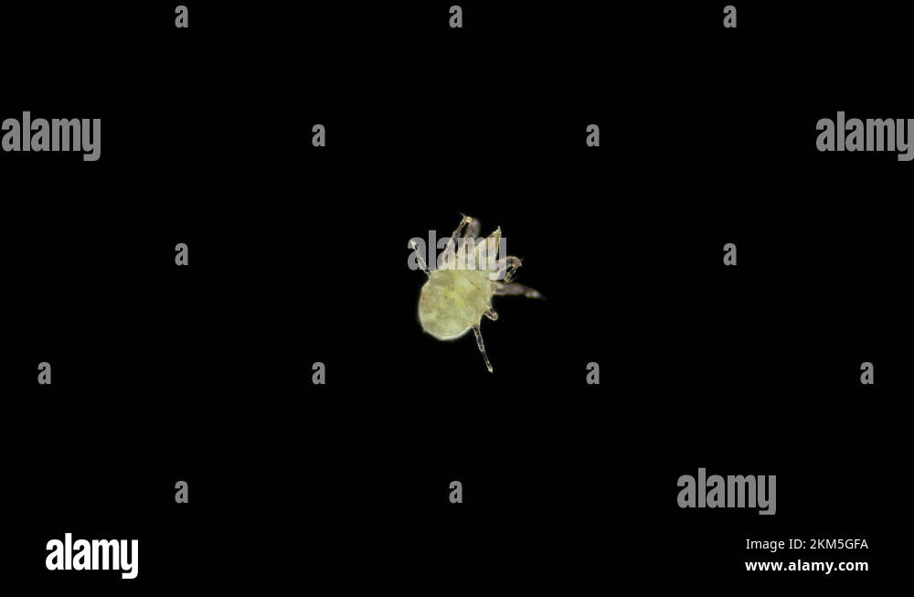 Soil mite of the Acaridae family under a microscope. saprophages Stock ...