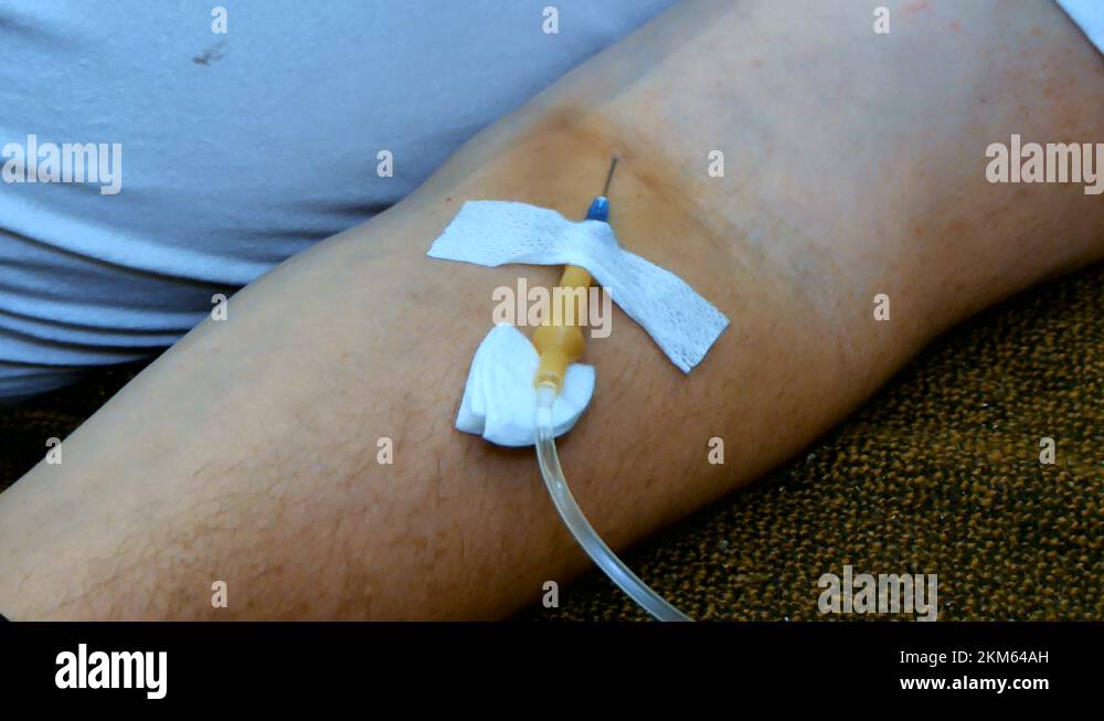 Butterfly catheter Stock Videos & Footage - HD and 4K Video Clips - Alamy