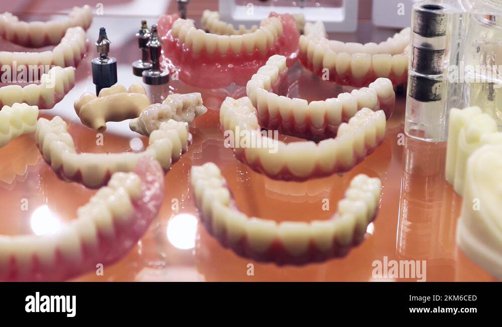 Samples with porcelain teeth and dental prosthesis Stock Video Footage ...