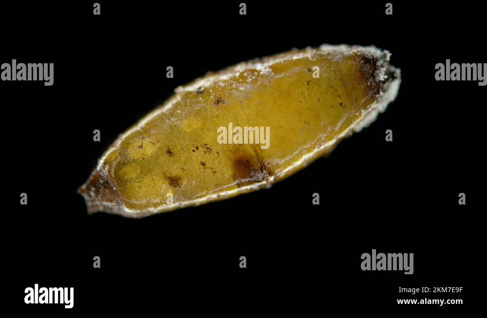 Colony Soil mites of the Acaridae family under a microscope. In an old ...