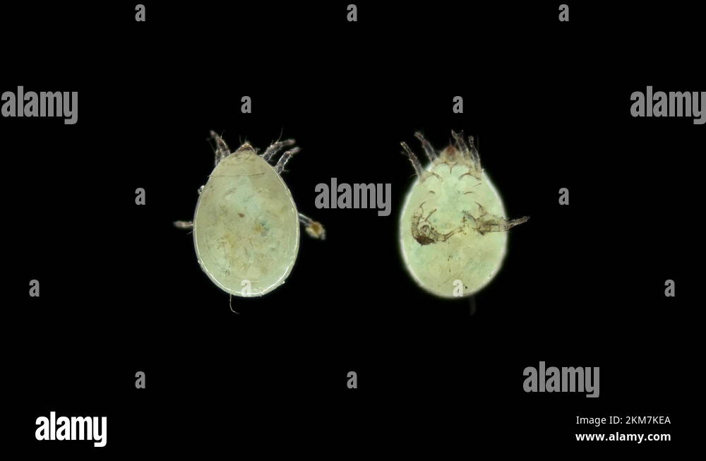 Soil mite of the Acaridae family under a microscope. saprophages Stock ...