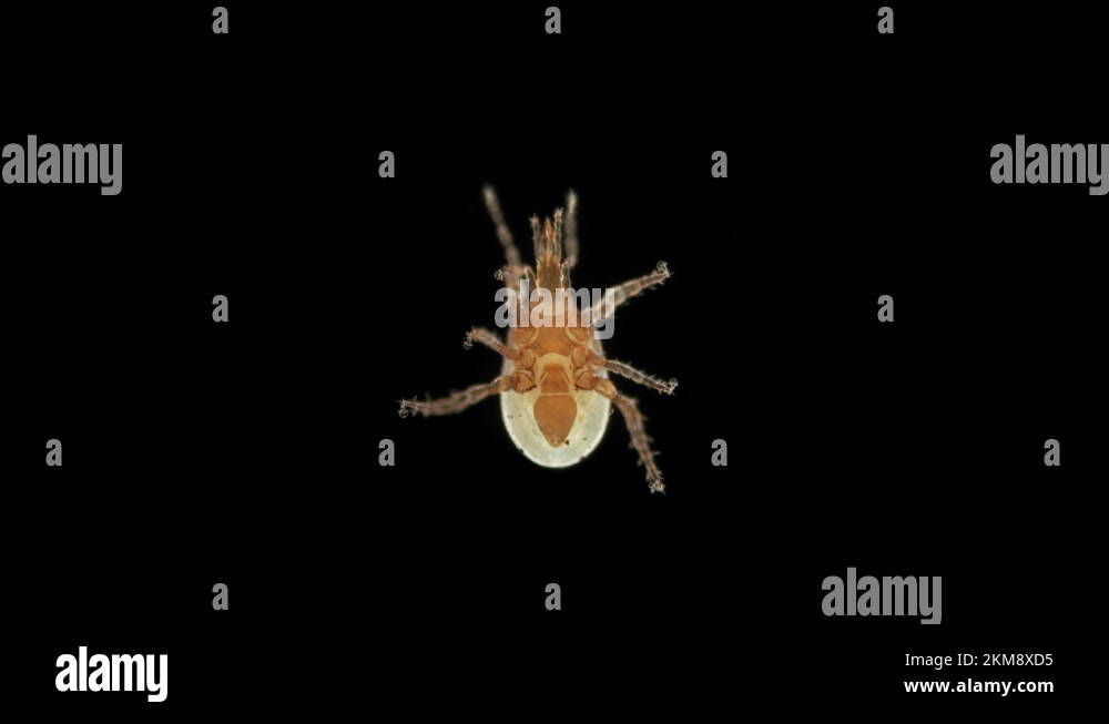 Predatory mite Macrocheles robustulus under a microscope Stock Video ...