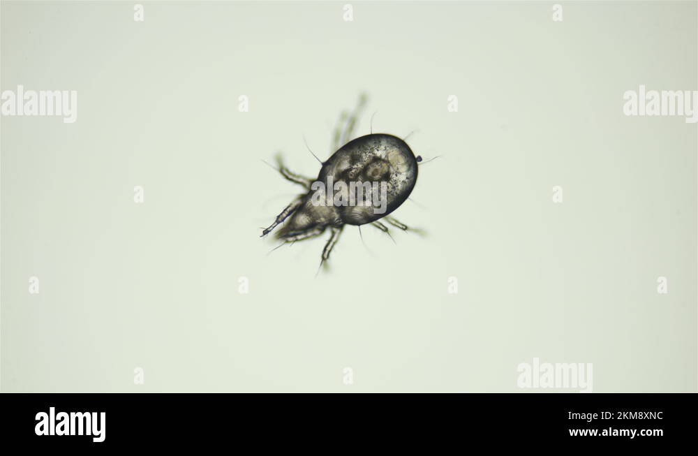 Soil mite of the Acaridae family under a microscope. saprophages Stock Video Footage - Alamy
