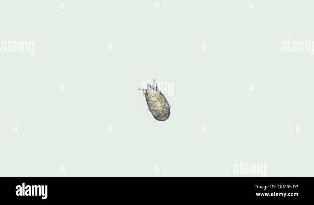 Mite(Acari) of the family Tarsonemidae under a microscope, order ...