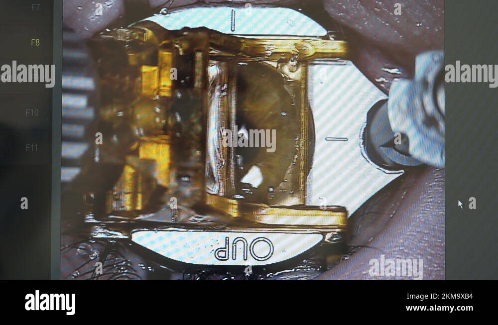 Microkeratome is slicing an eye layer in a close up Stock Video Footage ...