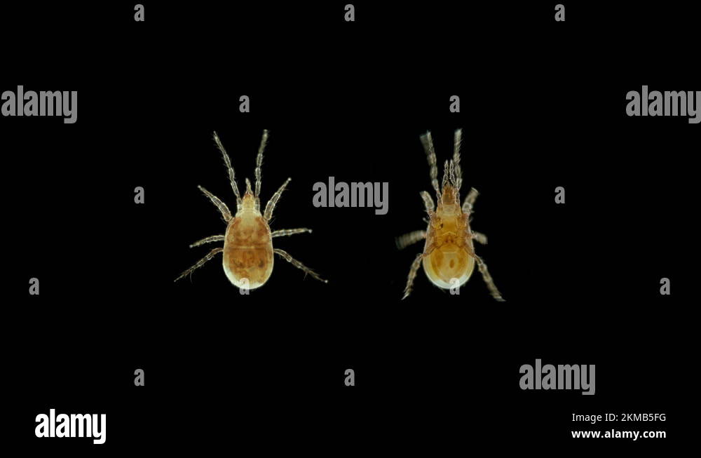 Predatory mite (acari) under a microscope, Parasitidae family Stock ...