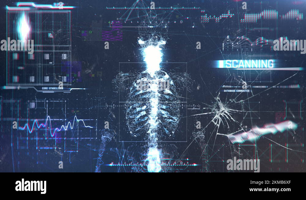 Human body scan on screen, software under hacking attack, technical ...