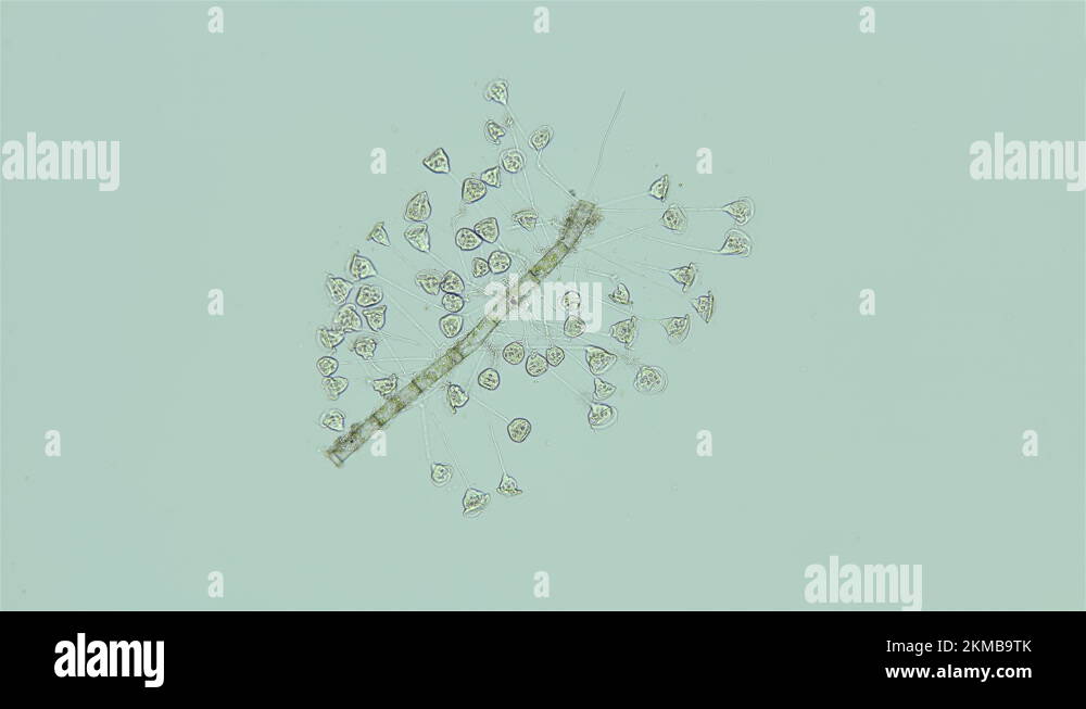 Infusoria Ciliophora Vorticella under the microscope, class ...