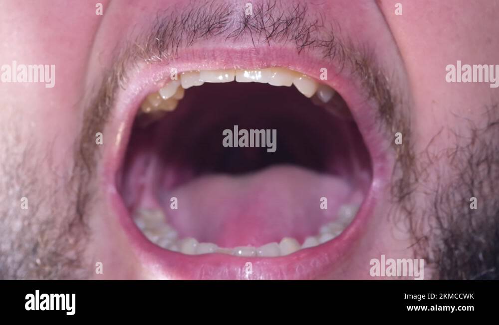Close up open mouth scream Stock Videos & Footage - HD and 4K Video ...