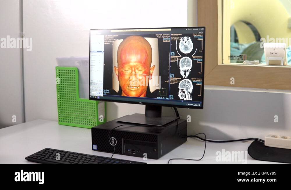 Mri monitor Stock Videos & Footage - HD and 4K Video Clips - Alamy