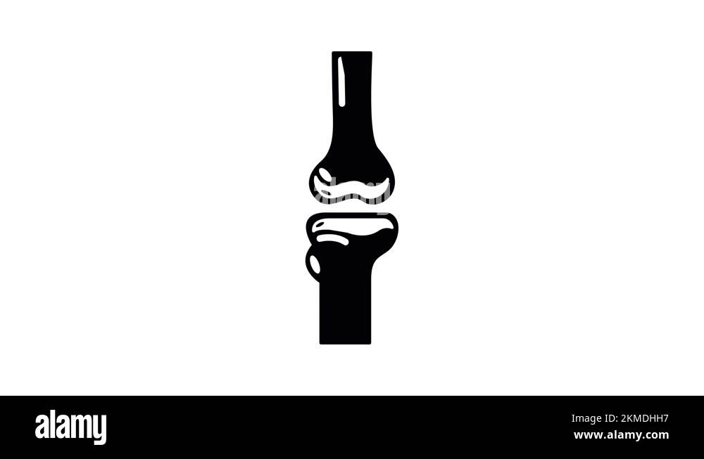 Inflammation illustration Stock Videos & Footage - HD and 4K Video ...