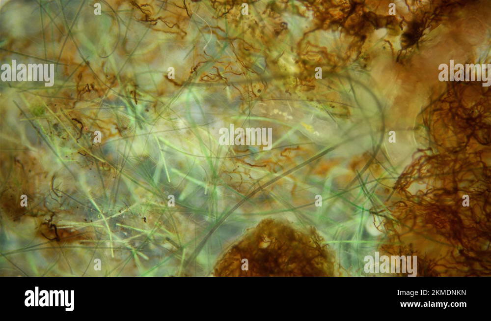 worms Nais sp. and Chaetogaster sp. under a microscope, Tubificidae ...