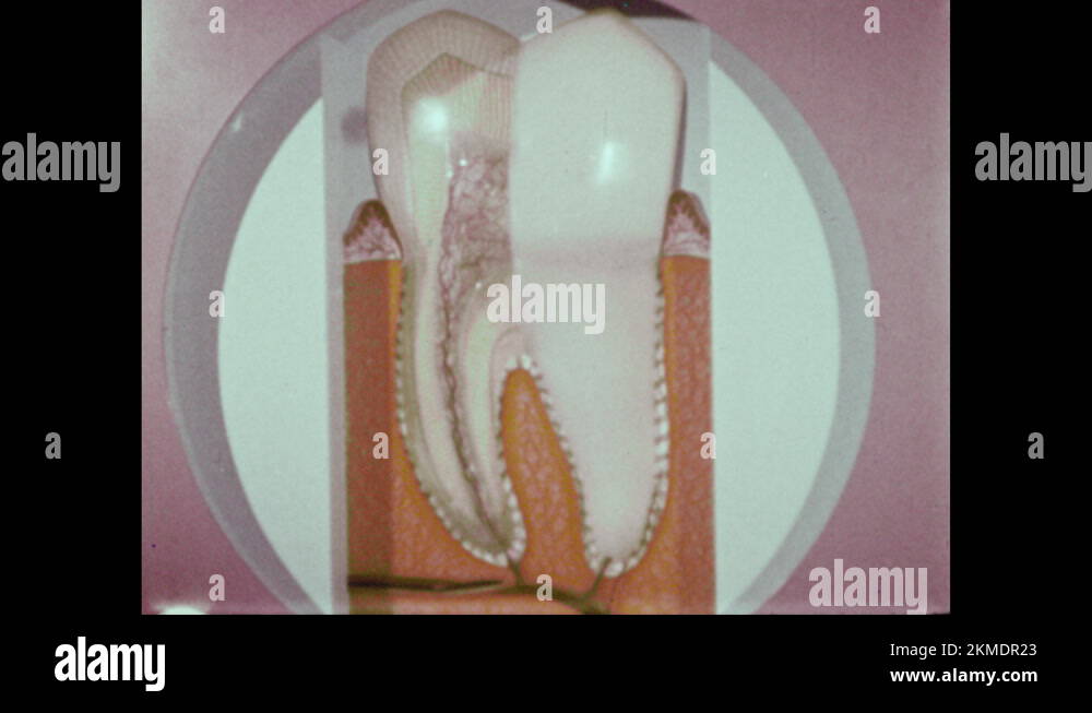 1970s: Cut-away model of a tooth. Parts of the tooth light up. Girl ...