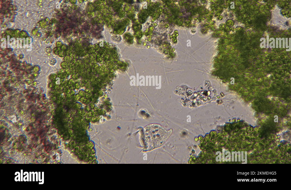 Protist amoeba proteus Stock Videos & Footage - HD and 4K Video Clips ...