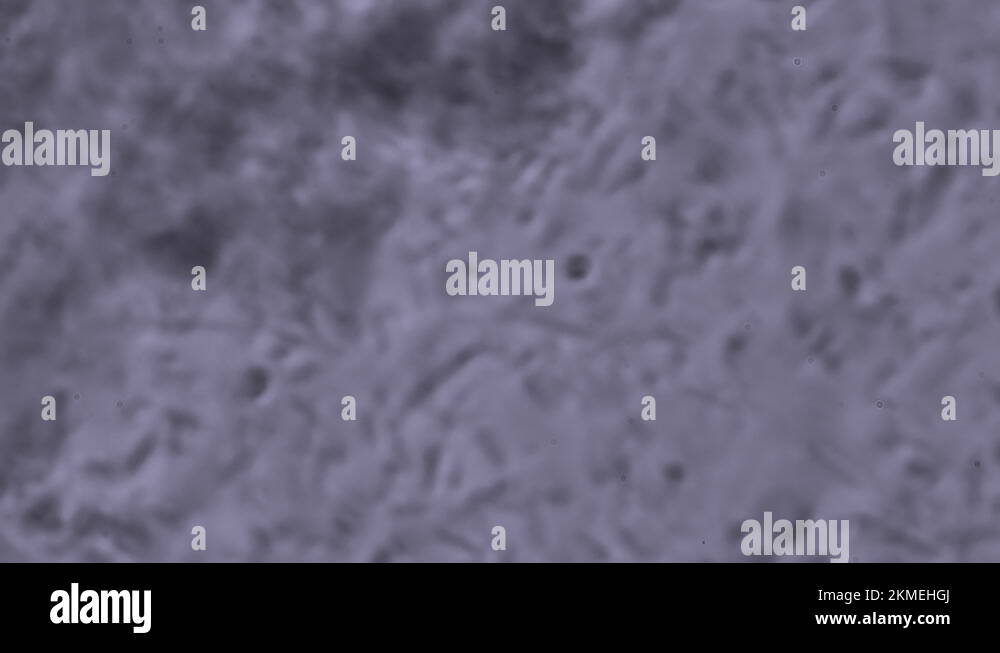 Streptococcus Staphylococcus, E. coli in human feces under a microscope ...