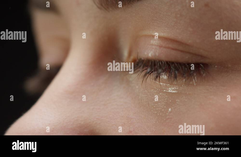 Watery eye Stock Videos & Footage - HD and 4K Video Clips - Alamy