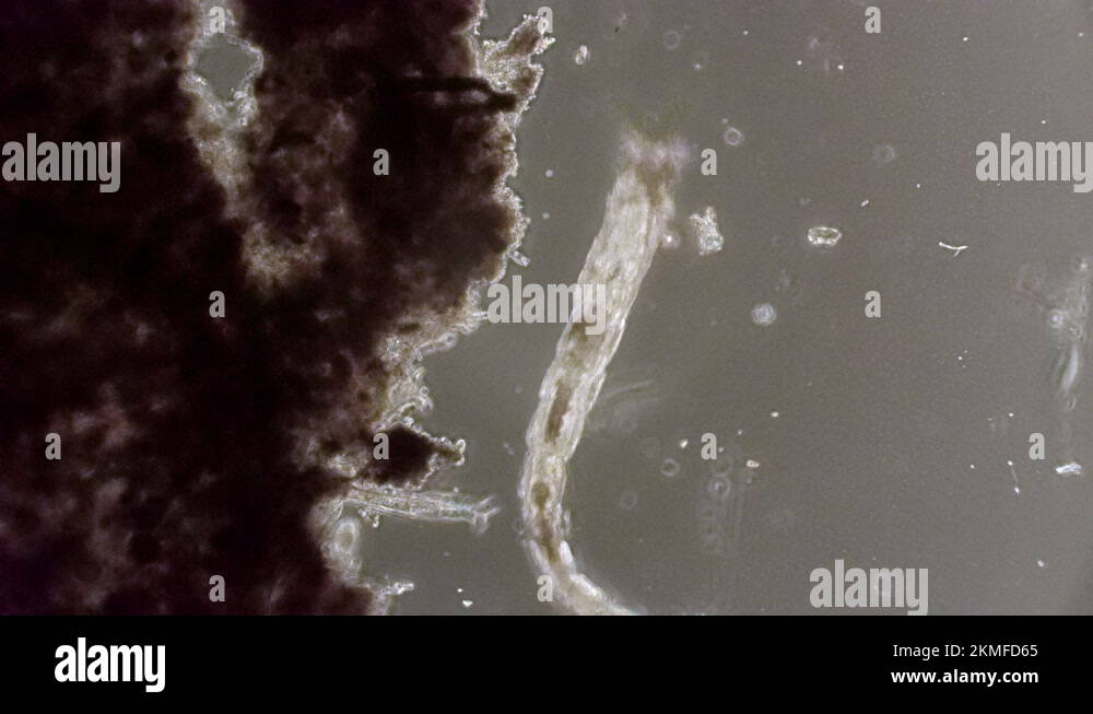 Microscopic animal Stock Videos & Footage - HD and 4K Video Clips - Alamy
