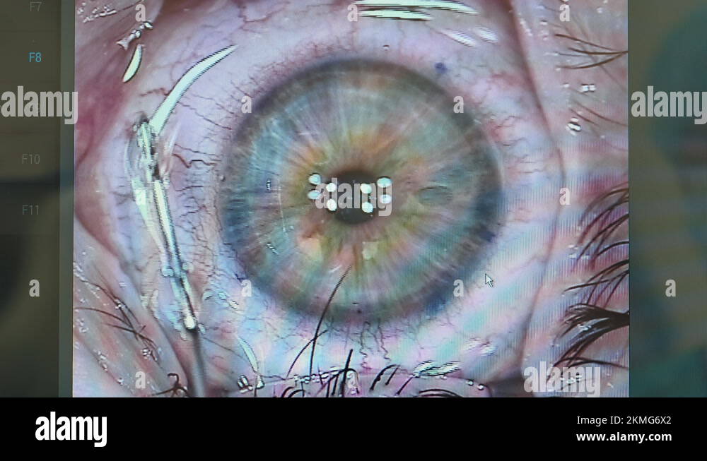 Eye layer Stock Videos & Footage - HD and 4K Video Clips - Alamy