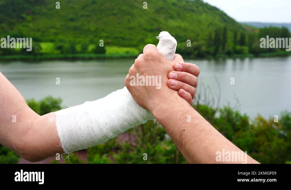 Arms in plaster Stock Videos & Footage - HD and 4K Video Clips - Alamy