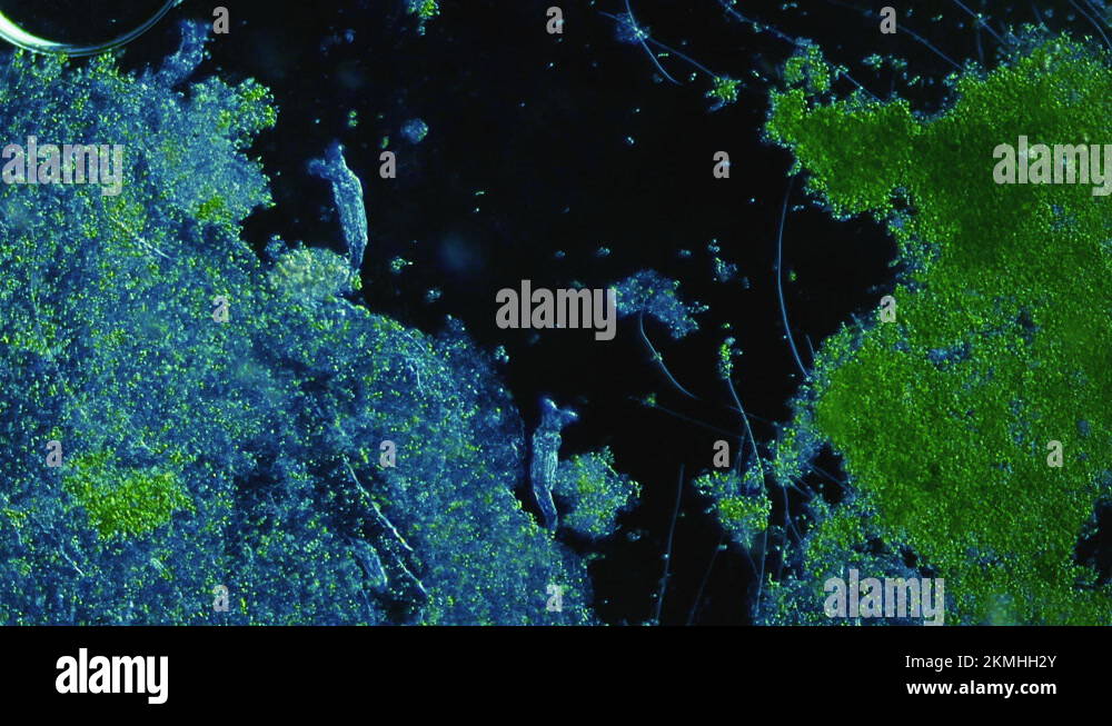 Microscopic image of paramecium Stock Videos & Footage - HD and 4K ...