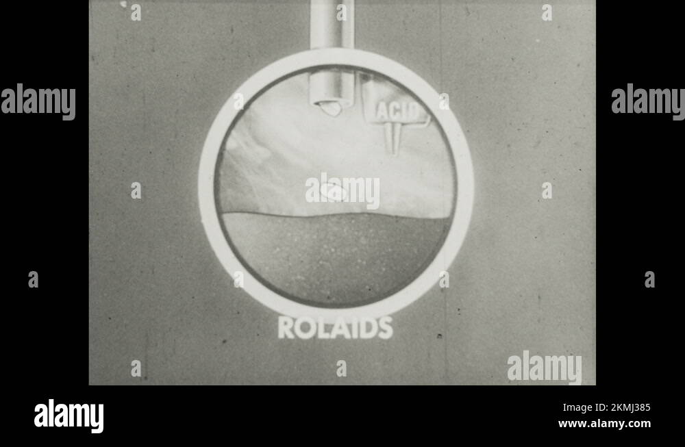 Stomach illustration acid Stock Videos & Footage - HD and 4K Video ...