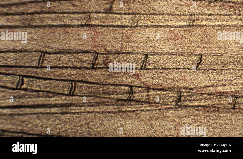 Microscopic blood vessels and capillaries carry blood cells Stock Video ...