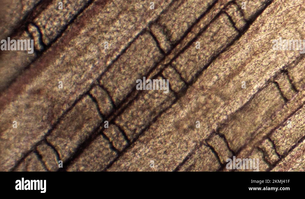 Tiny capillaries carry blood cells on a microscopic level Stock Video ...